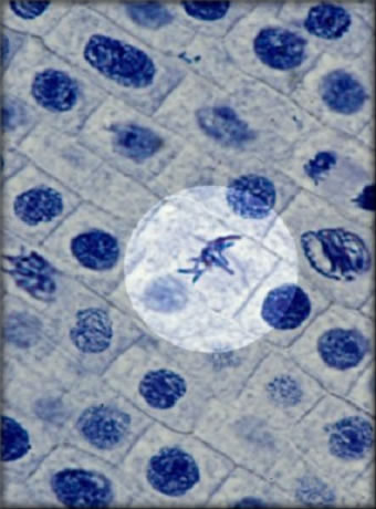 Onion Root Tip Showing Mitosis