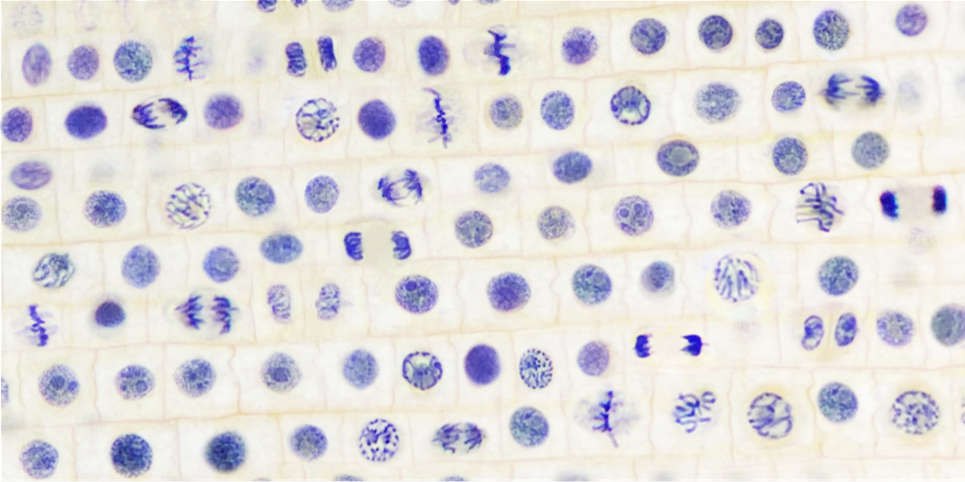 Stages Of Mitosis In Onion Root Tip
