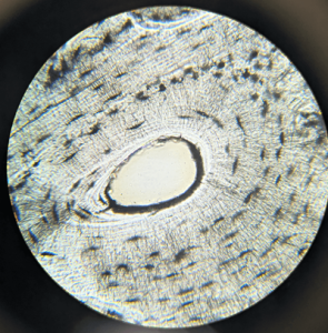 Bone Anatomy and Physiology - Resources for Students