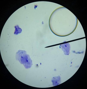 Cheek Cells