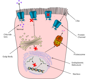 Case Study: Cystic Fibrosis Mutations