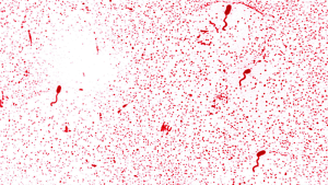 Case Study: How to Survive a Cholera Epidemic